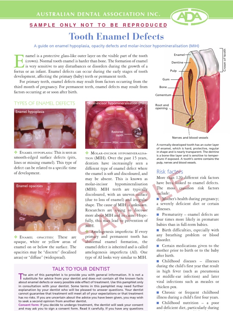 Tooth Enamel Defects: Australian Dental Association Inc