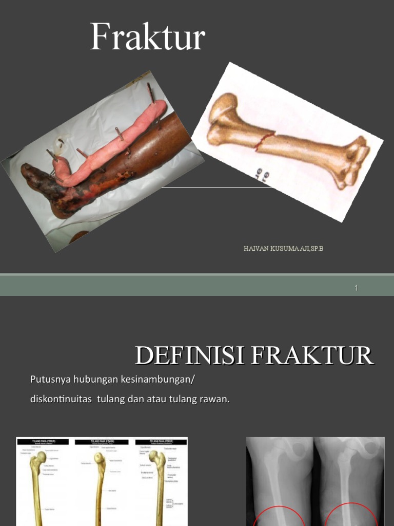 Fraktur Terbuka - Tertutup | PDF
