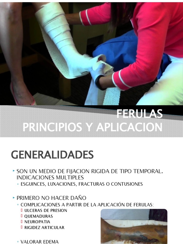 Tipos y Aplicaciones de Férulas | PDF | Rodilla | Tobillo