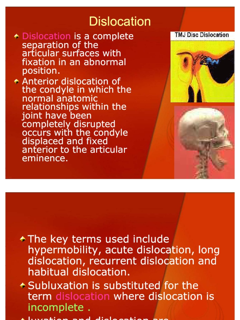 TMJ Dislocation | PDF | Joint | Clinical Medicine