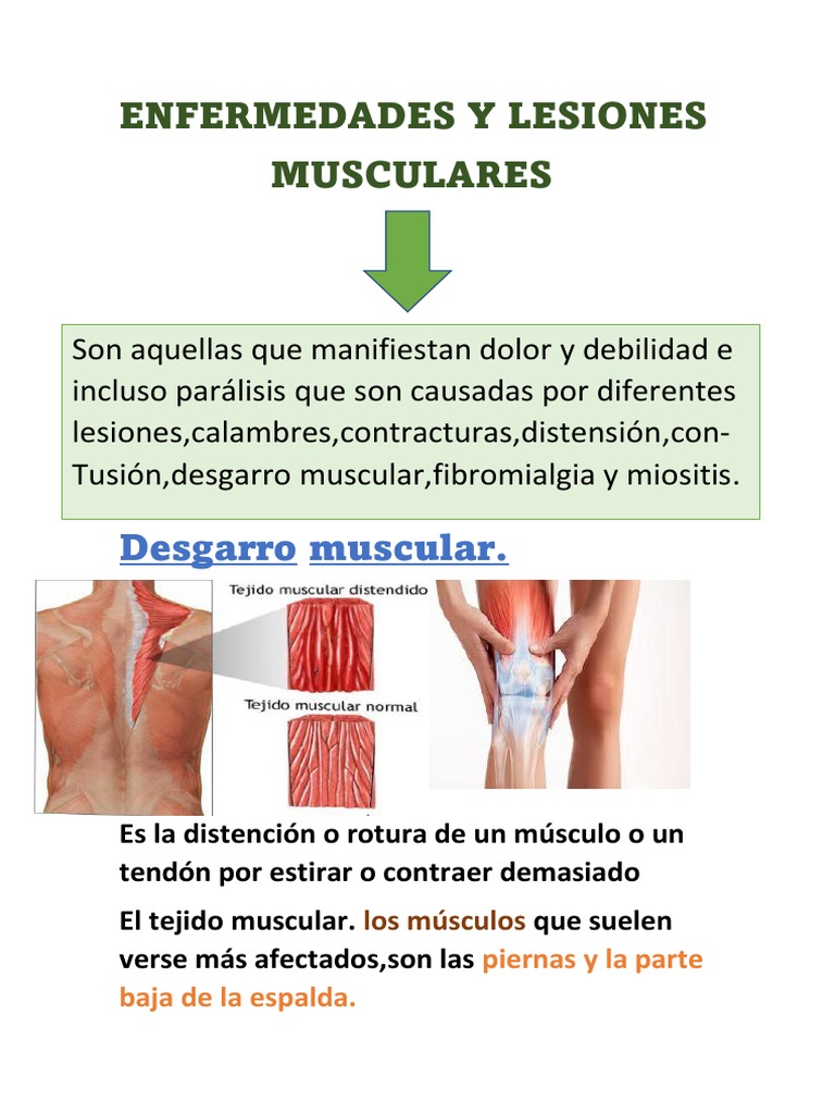 Enfermedades Y Lesiones Musculares: Desgarro Muscular | PDF | Músculo ...
