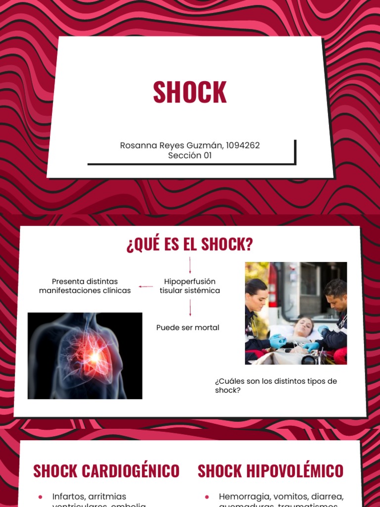 Tipos de Shock Circulatorio | PDF | Choque (circulatorio) | Medicina