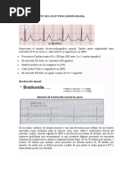 16 - Ritmo Sinusal Normal | PDF | Cardiología | Corazón
