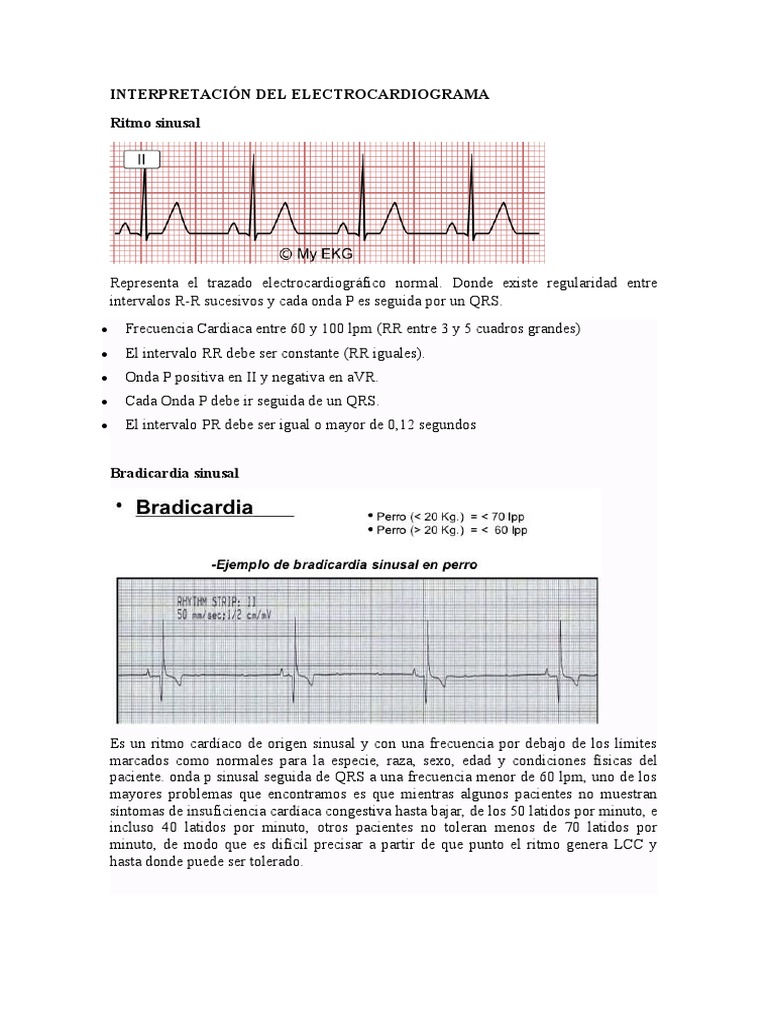 Interpretación Del Electrocardiograma | PDF | Electrocardiografia | Arritmia cardiaca