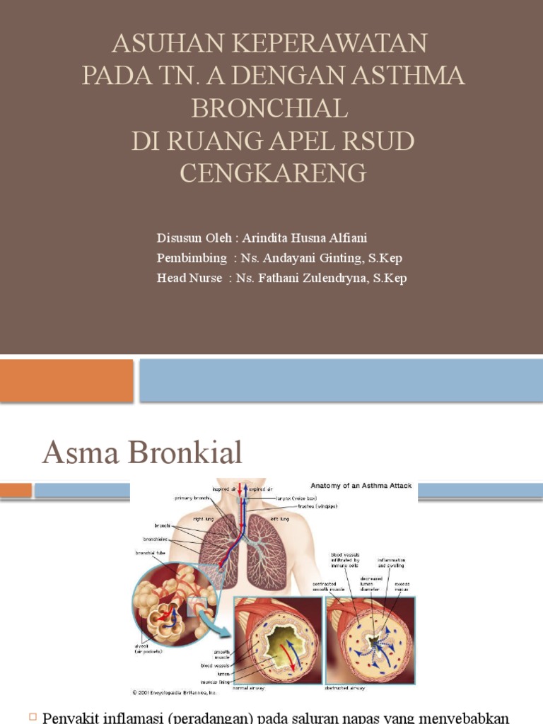 Presentasi Kasus Asma | PDF