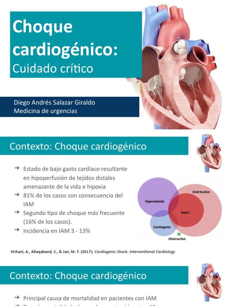 Choque cardiogénico | PDF | Choque (circulatorio) | Infarto de miocardio