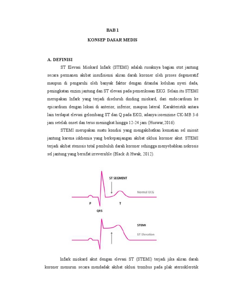 LP Stemi (Igd PJT) | PDF