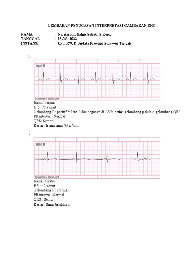 18 Juli (1) Interpretasi Gambaran EKG | PDF