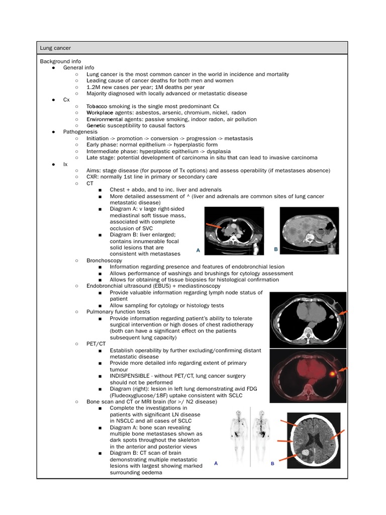 Cancer notes | PDF | Prostate Cancer | Lung Cancer