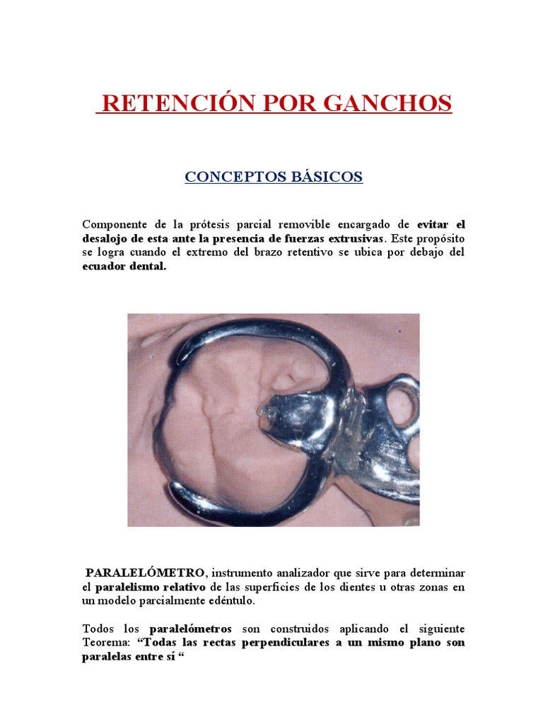 Ganchos Conceptos Generales 2 | PDF | Dentadura postiza | Ramas de ...