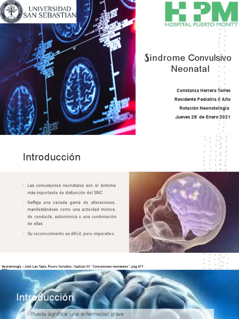Sindrome de Convulsion Neonatal | PDF | Epilepsia | Benzodiazepinas