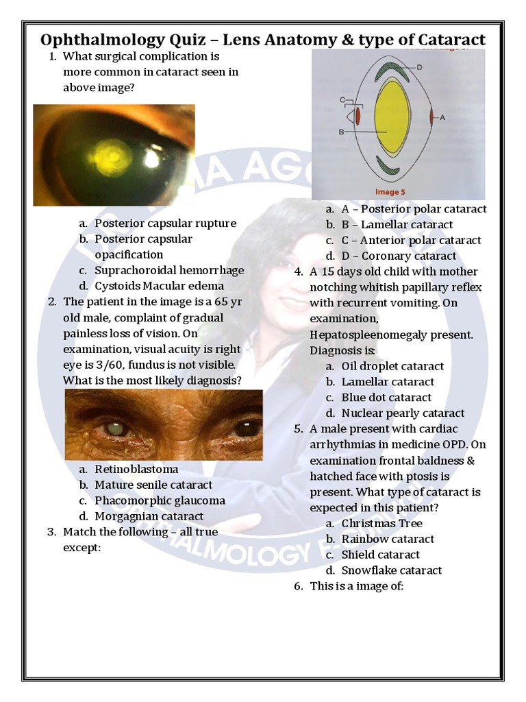 Ophtha Quiz - Lens Anatomy & Type of Cataract | PDF | Cataract | Light