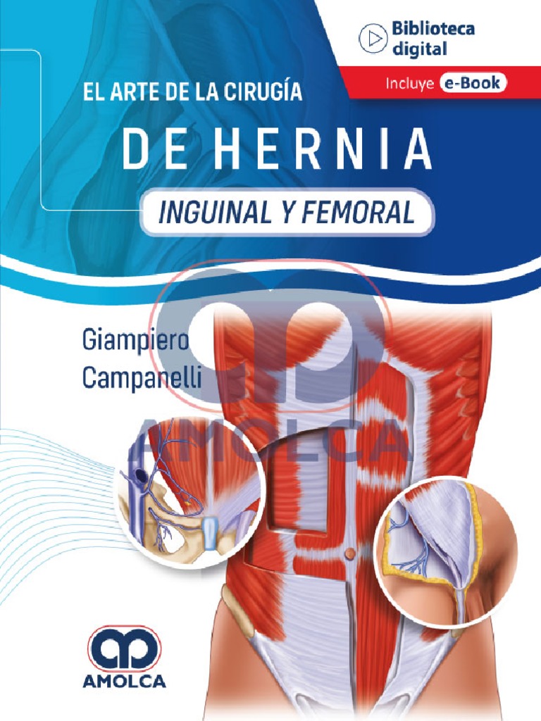 El Arte de La Cirugía de La Hernia - Inguinal y Femoral | PDF | Cirugía | Abdomen