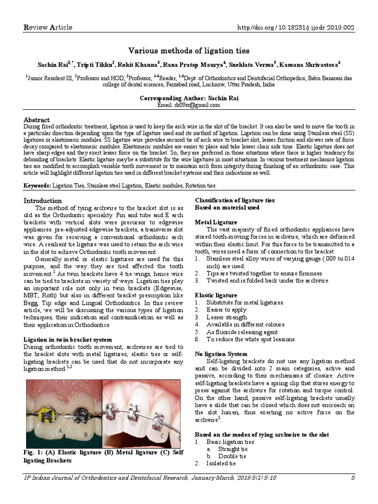 Various Methods of Ligation Ties: Review Article | PDF | Orthodontics ...