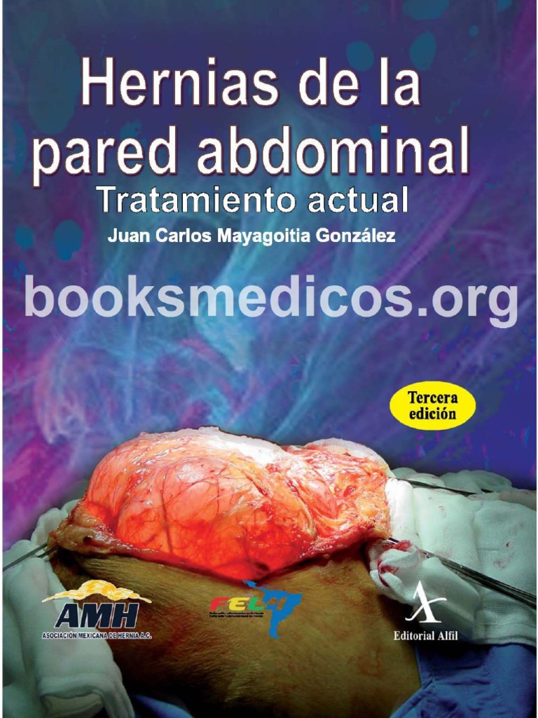Hernias de La Pared Abdominal Mayagoitia | PDF | Cirugía | Medicina