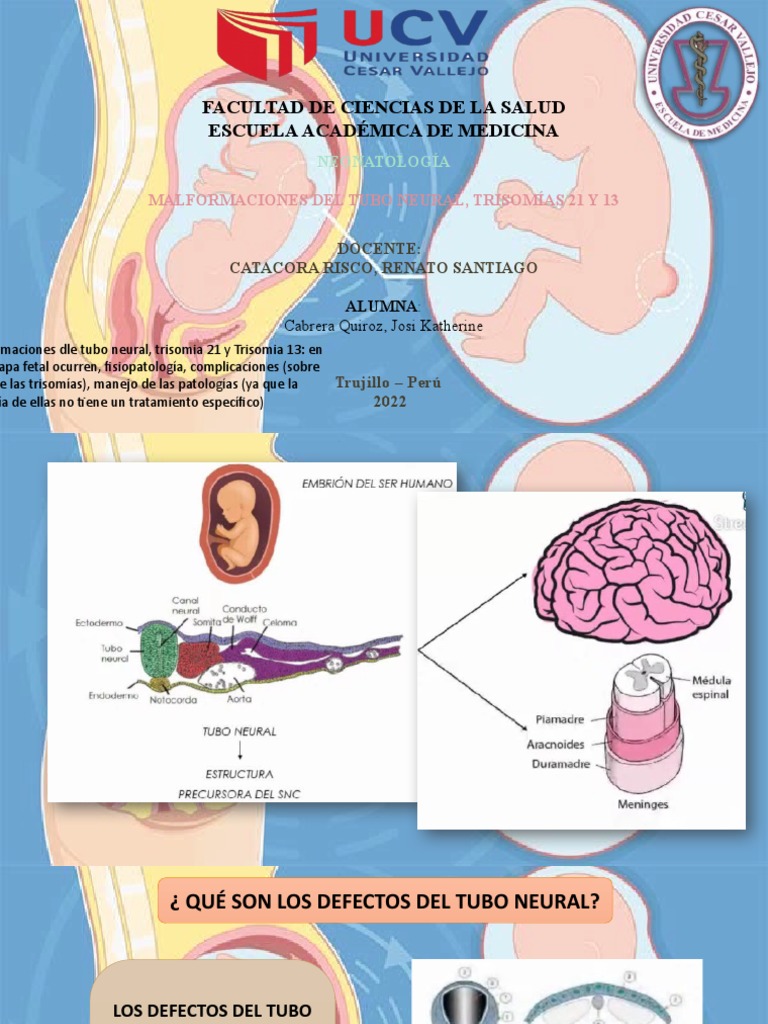 Defectos Del Tubo Neural, Trisomías 21 y 13 | PDF | Mitosis | Especialidades Medicas