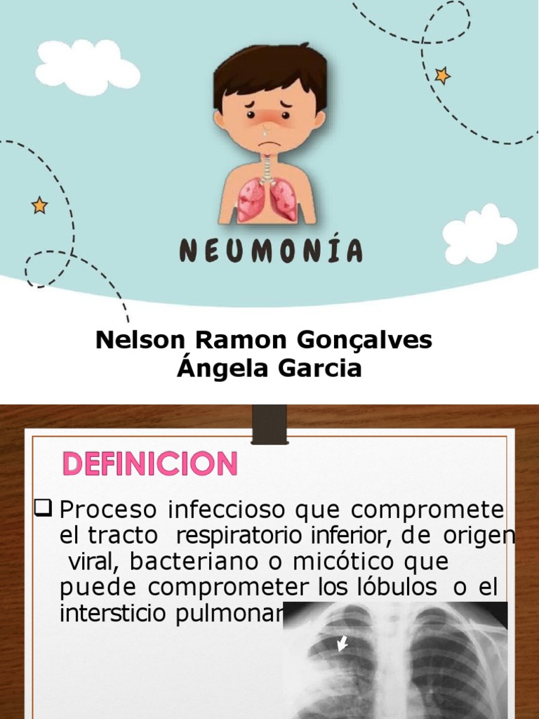 Neumonía en Niños: Causas y Diagnóstico | PDF | Neumonía | Epidemiología