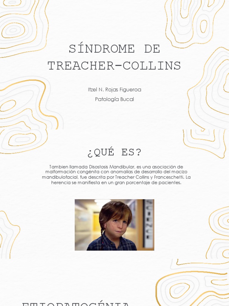 Treacher Collins | PDF | Enfermedades y trastornos humanos | Epidemiología