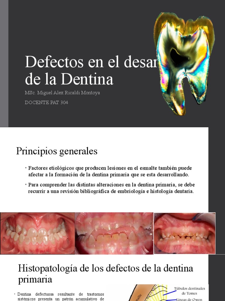 Defectos en Dentina: Causas y Tipos | PDF | Dentina | Diente