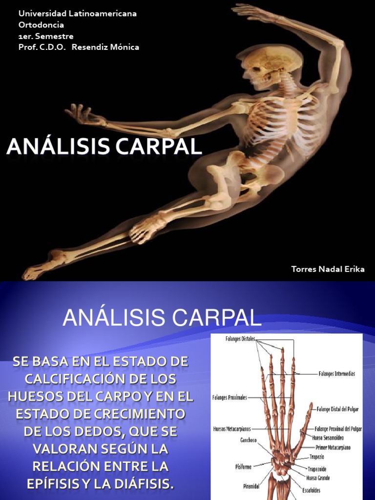 Análisis del método de análisis carpales y su importancia en la ...