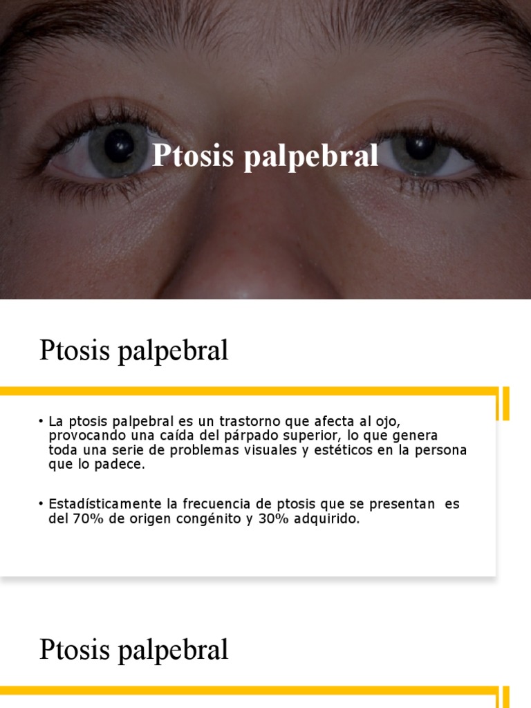 Ptosis Palpebral y Chalazion | PDF | Ojo humano | Epidemiología