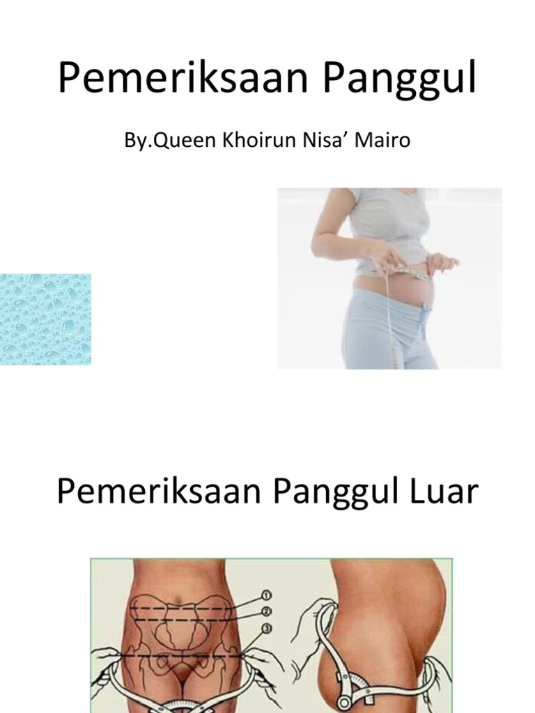 Cara Mengukur Panggul Secara Luar Untuk Mendeteksi Kelainan | PDF