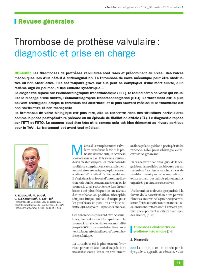 04 Thrombose Prothèse Valvualaire | PDF | Cœur | Médecine clinique