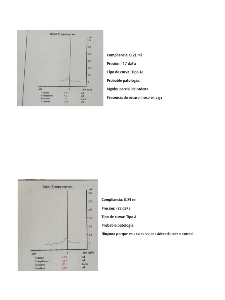 Curvas de Jerger | PDF