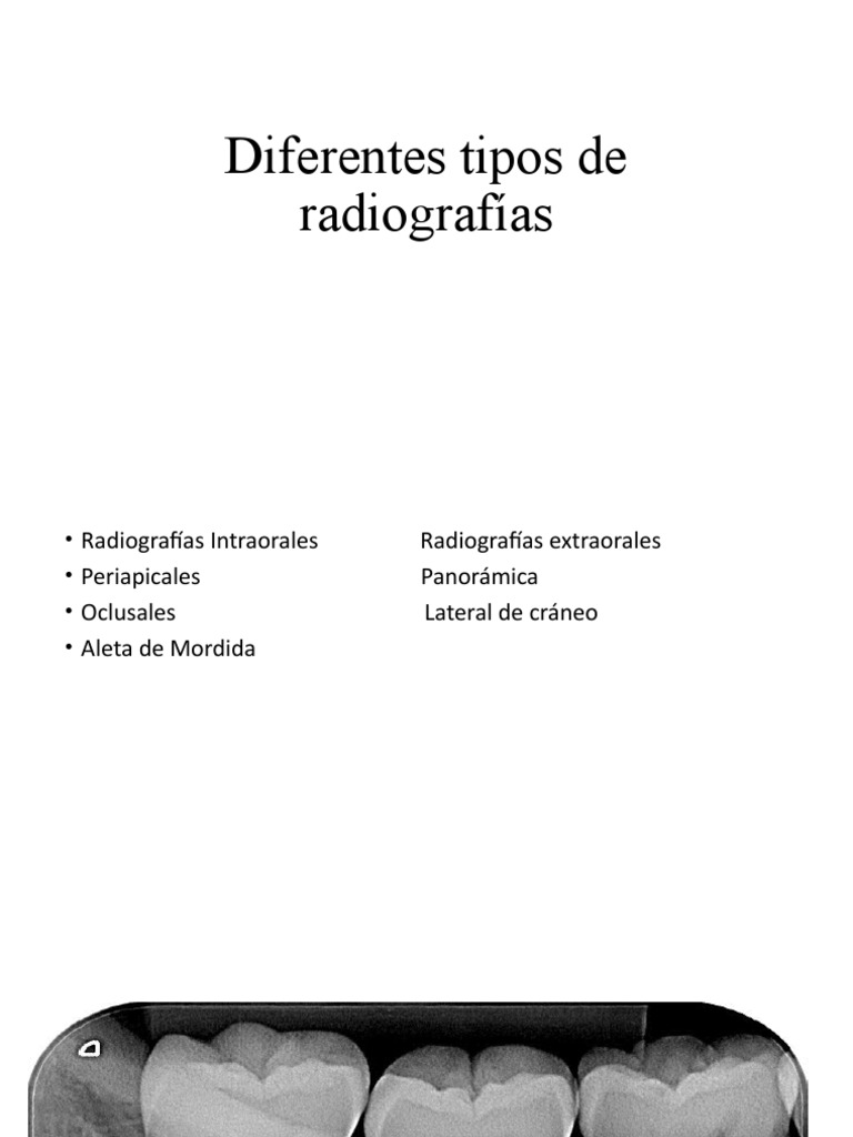 Diferentes Tipos de Radiografías | PDF