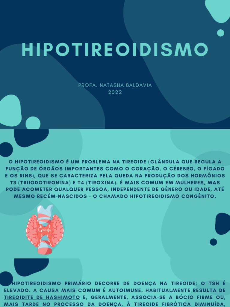 Hipotireoidismo: causas, sinais e sintomas e tratamento | PDF | Tireoide | Hipertireoidismo