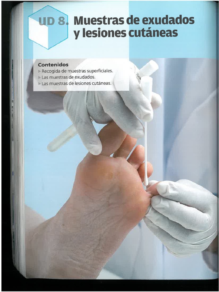 GMB UD8 - Muestras de Exudados y Lesiones Cutáneas | PDF