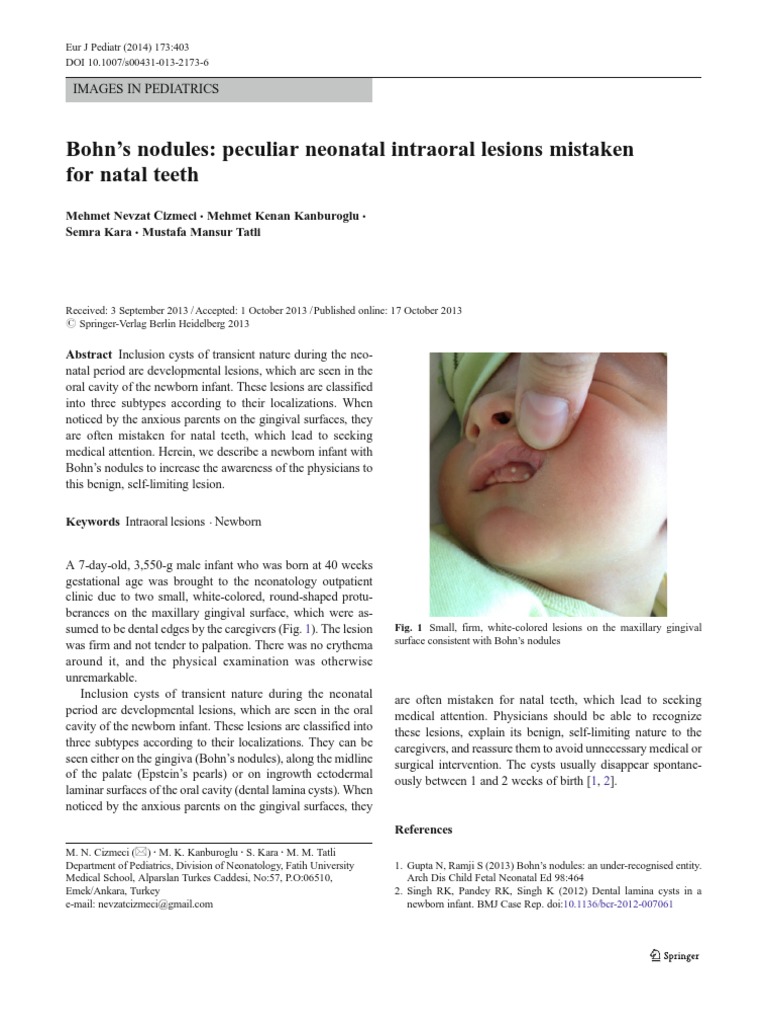 Nodulos de Bohn | PDF | Medical Specialties | Health Sciences