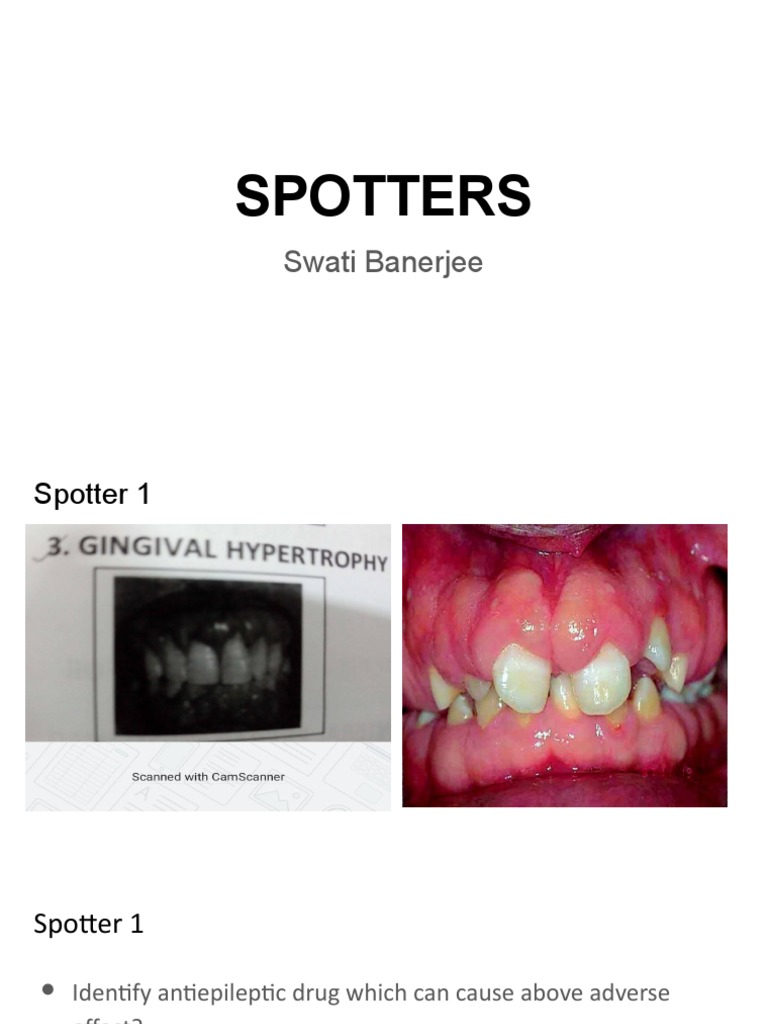SPOTTERS 1st Internal Pharma | PDF | Pharmacology | Clinical Medicine