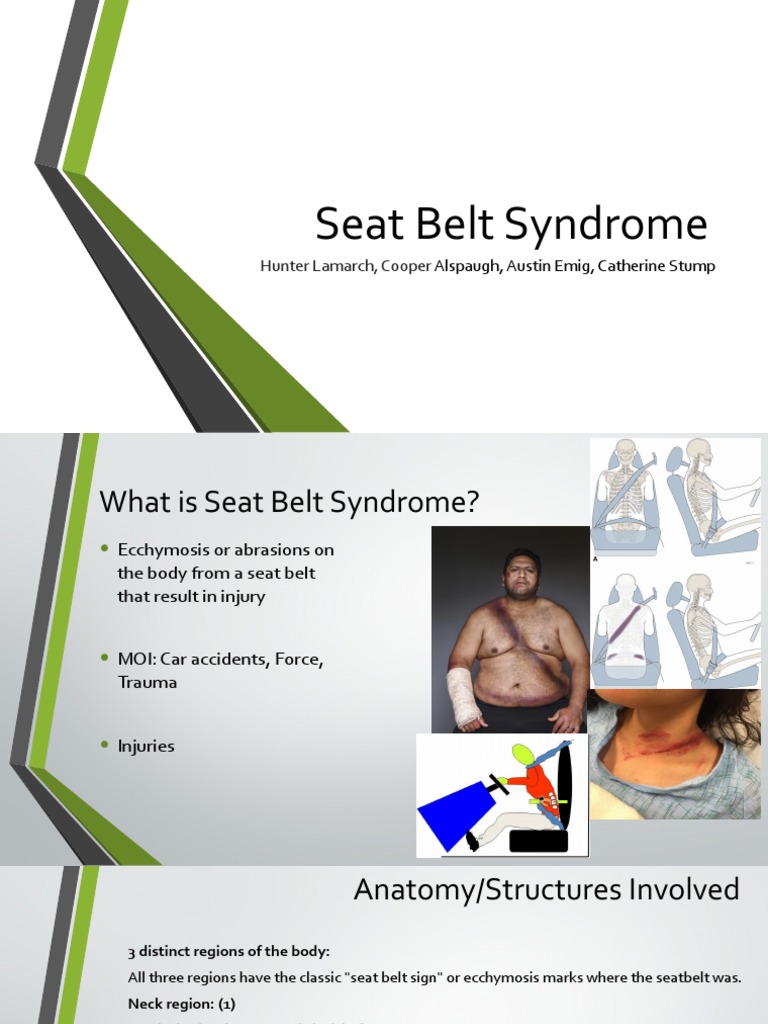 Seat Belt Syndrome PTH 630 Anatomy and Phys | PDF | Thorax | Clinical ...