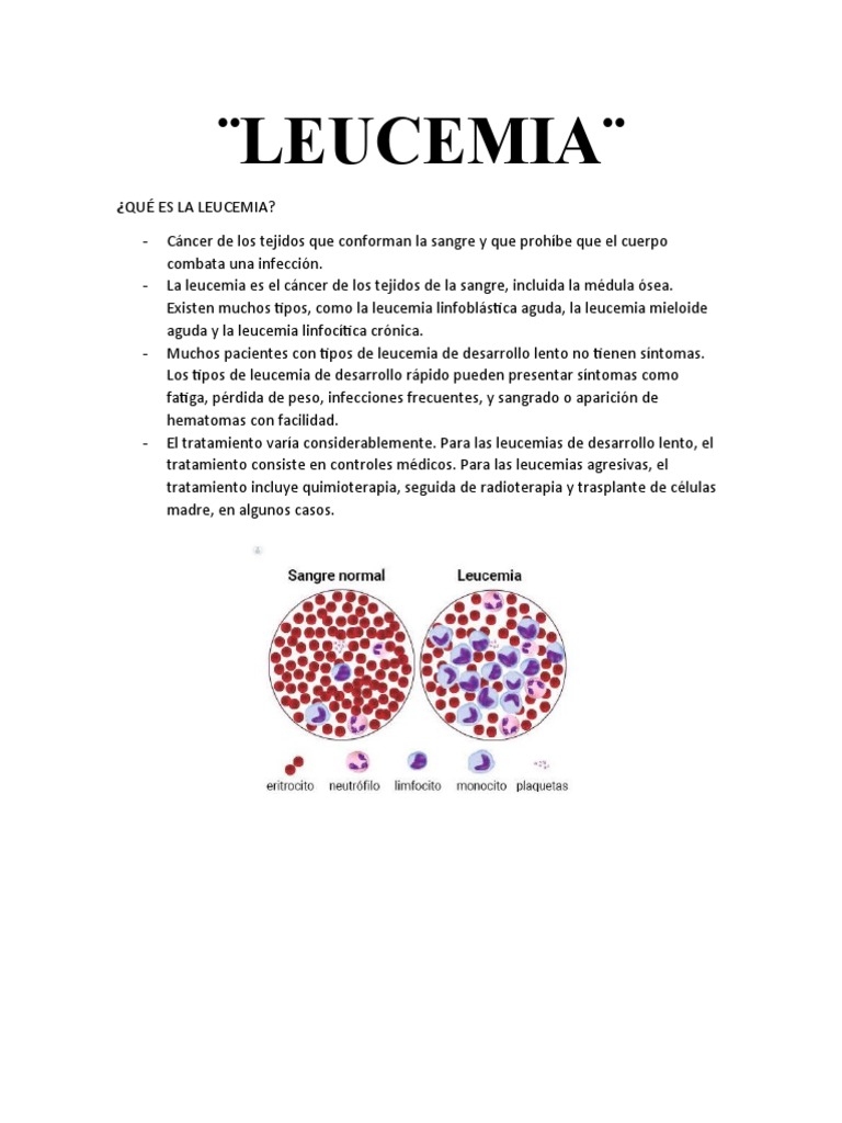 LEUCEMIA | PDF | Leucemia | Cáncer