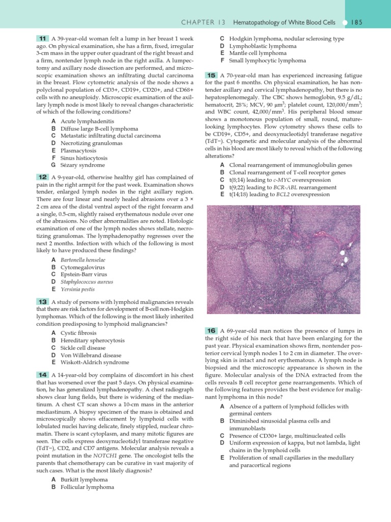 C H A P T E R 1 3 Hematopathology of White Blood Cells 1 8 5 | PDF | Lymphoma | Lymphatic System