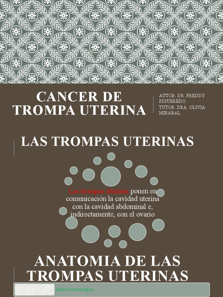 Cancer de Trompa Uterina 1 | PDF | Cáncer | Metástasis