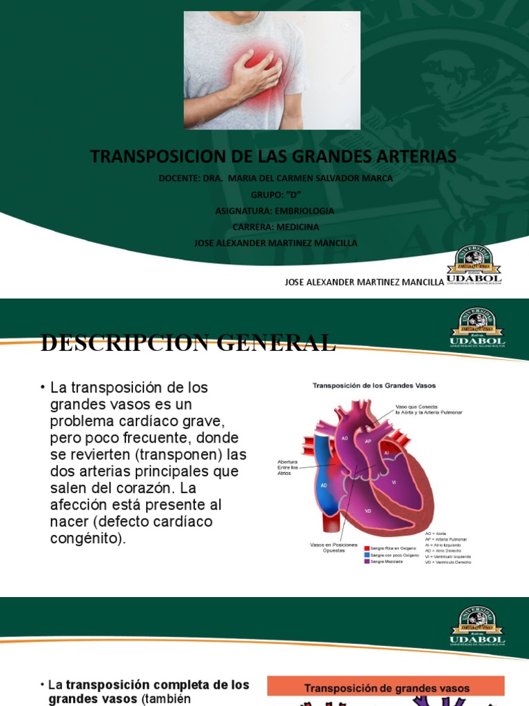 Transposicion de Las Grandes Arterias-Jose Alexander Martinez Mancilla ...