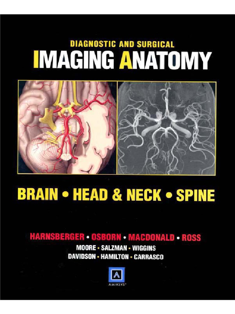 Diagnostic Imaging Anatomy Brain Head & Neck Spine | PDF | Skull ...