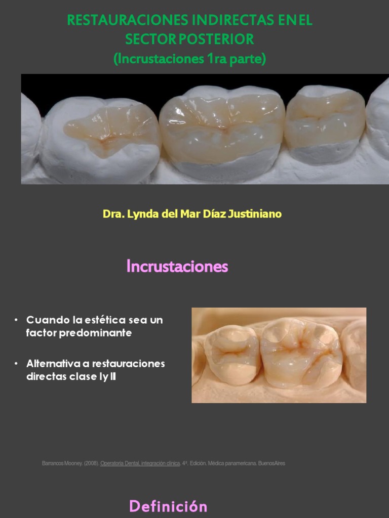 RESTAURACIONES INDIRECTAS POST (1ra Parte) | PDF | Odontología | Ramas ...
