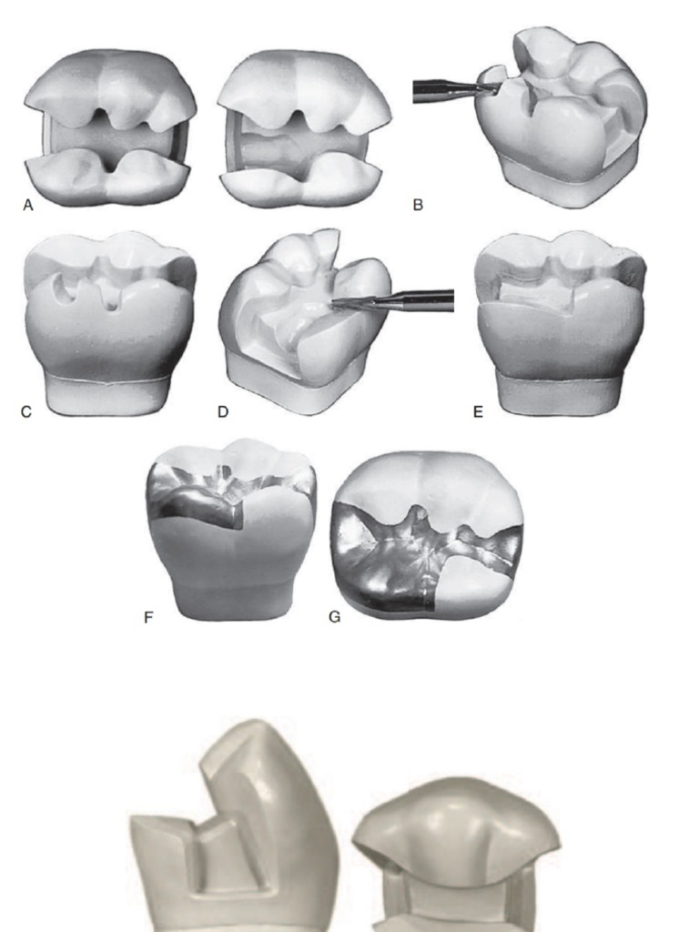 Cusp Reduction | PDF