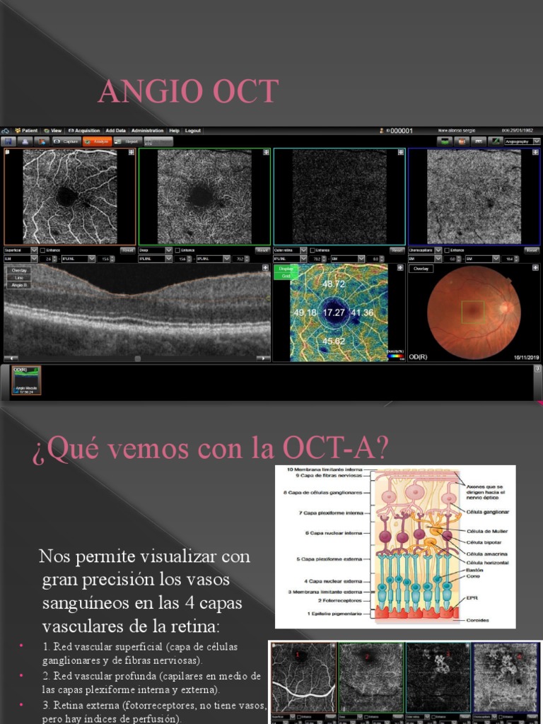 Angio Oct | PDF | Retina | Anatomía humana