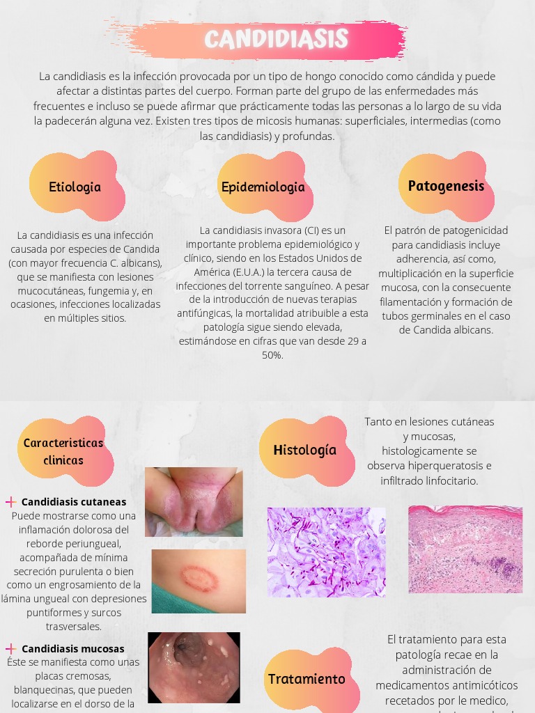 Candidiasis Cartél | PDF | Candidiasis | Especialidades Medicas