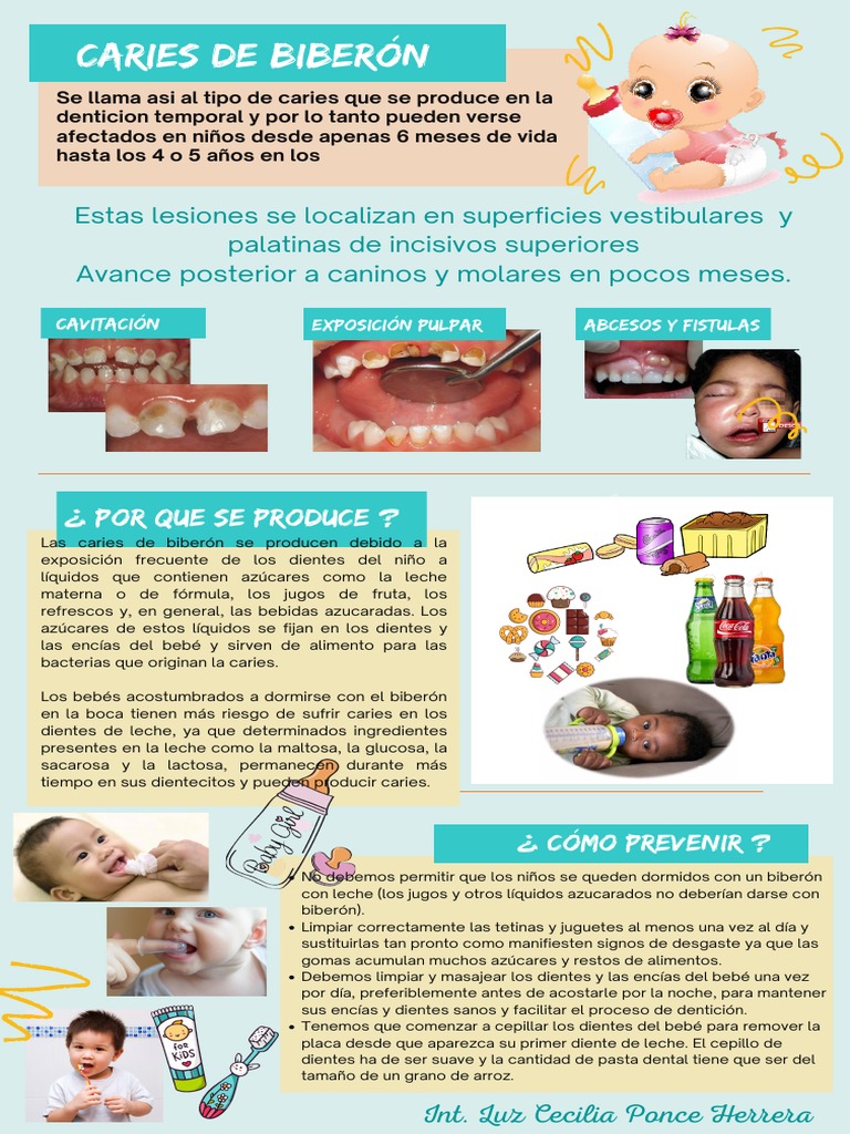 Caries de Biberon | PDF | Diente | Leche