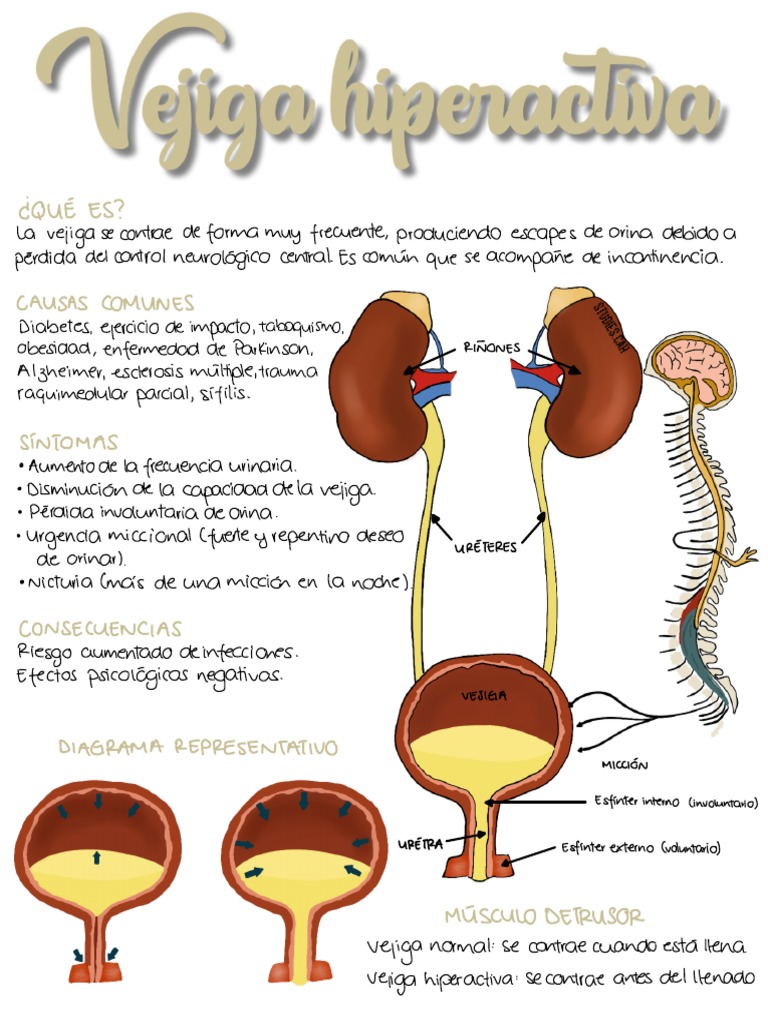 Vejiga Hiperactiva | PDF | Vejiga urinaria | Micción