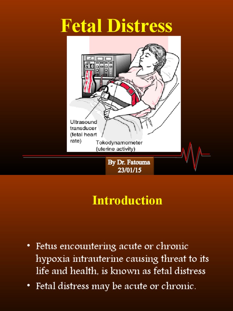 Fetal Distress | PDF | Preterm Birth | Fetus