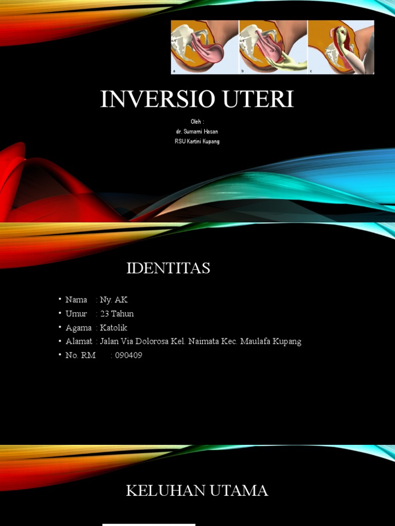 Inversio Uteri | PDF