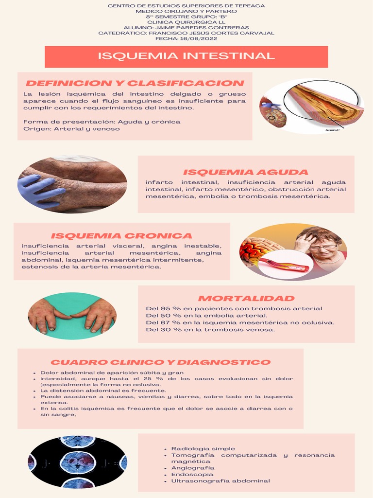 Isquemia Intestinal y Tce | PDF | Isquemia | Infarto de miocardio
