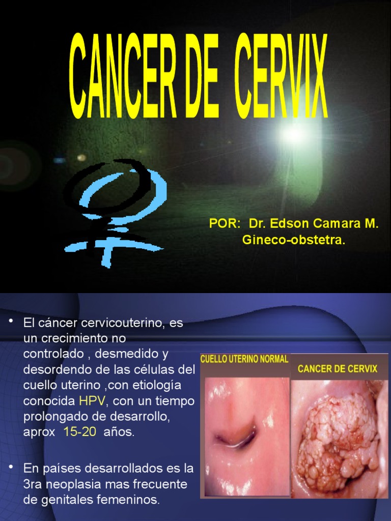 Cancer de Cervix | PDF | Especialidades Medicas | Medicina