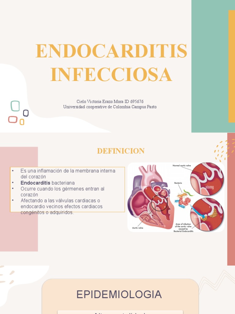 Endocarditis Infecciosa..... | PDF | Epidemiología | Especialidades Medicas